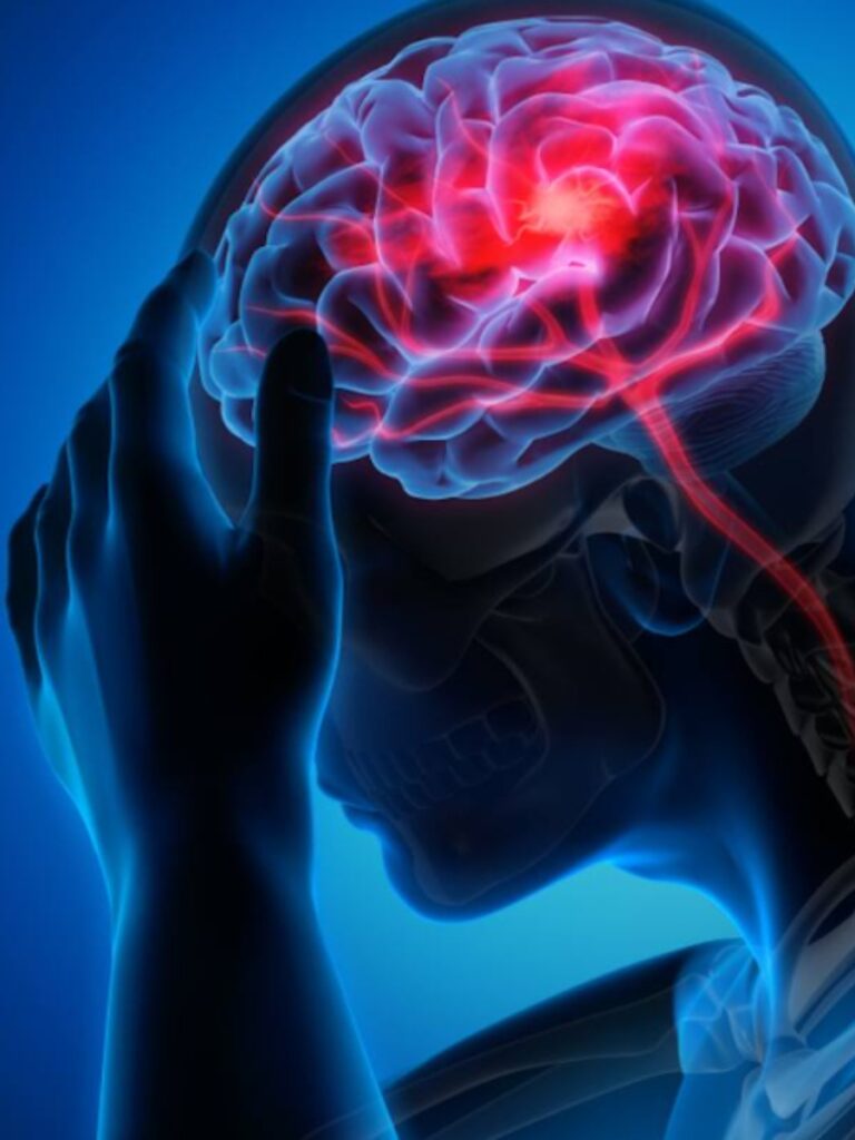 Ictus, gli 8 segnali da non sottovalutare mai: ti salvano la vita - TvZap